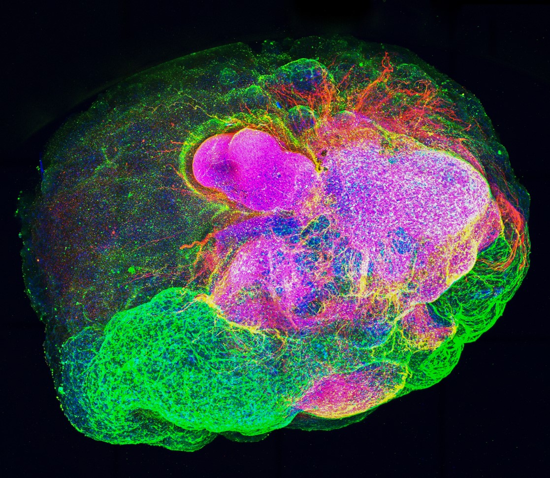 Using tiny brains to treat rare, hereditary diseases - Australian ...