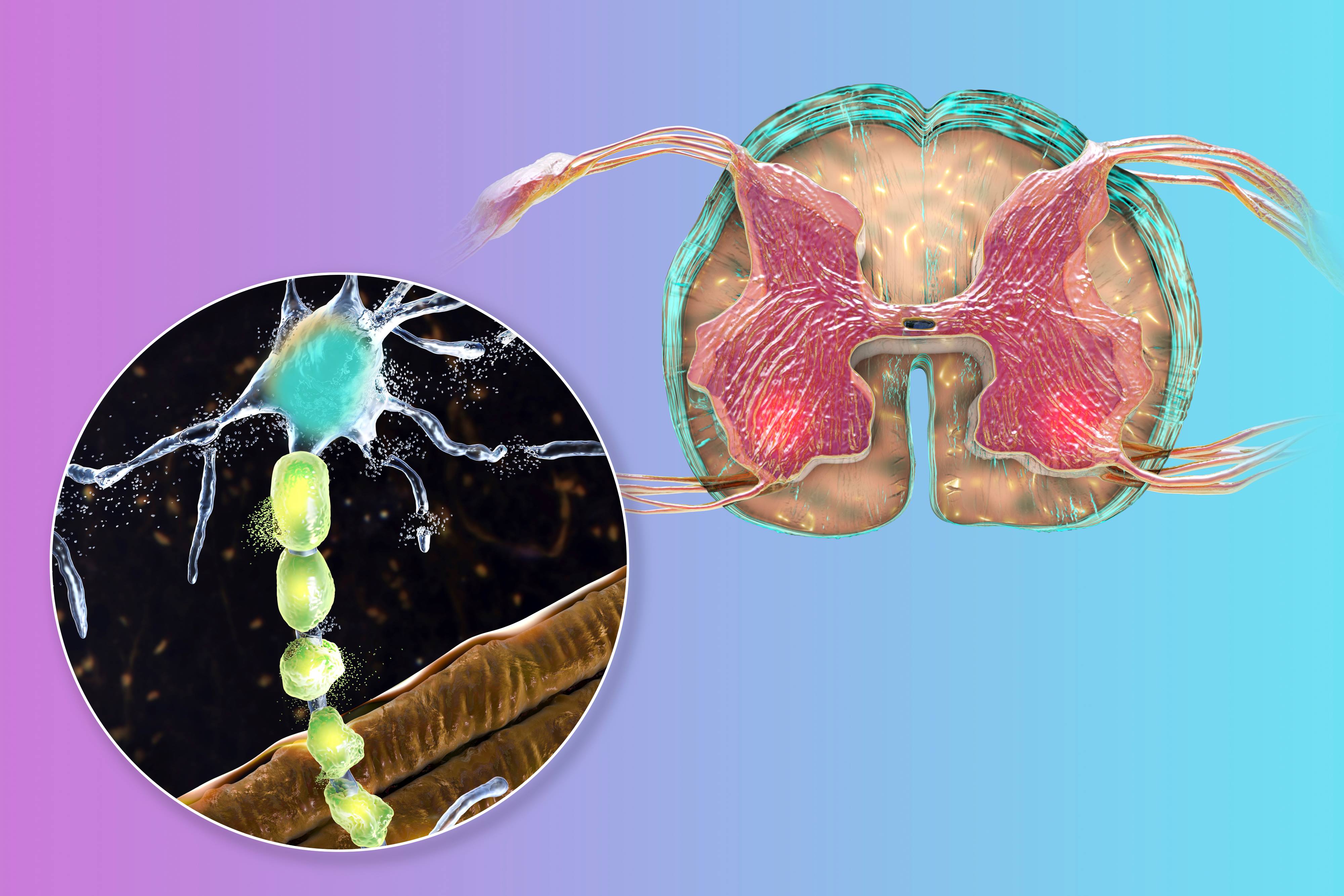 AIBN researcher set to tackle MND lipid puzzle with Scott Sullivan Fellowship - Australian ...